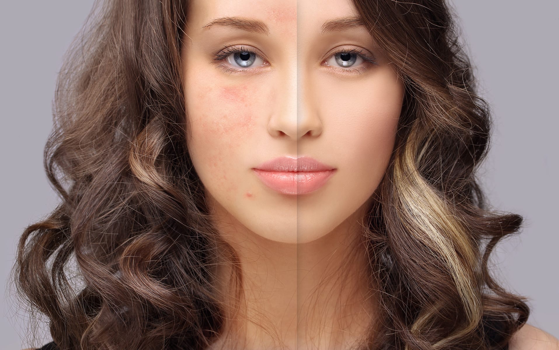 Common Skin Problems and Solutions - Clave Body Care